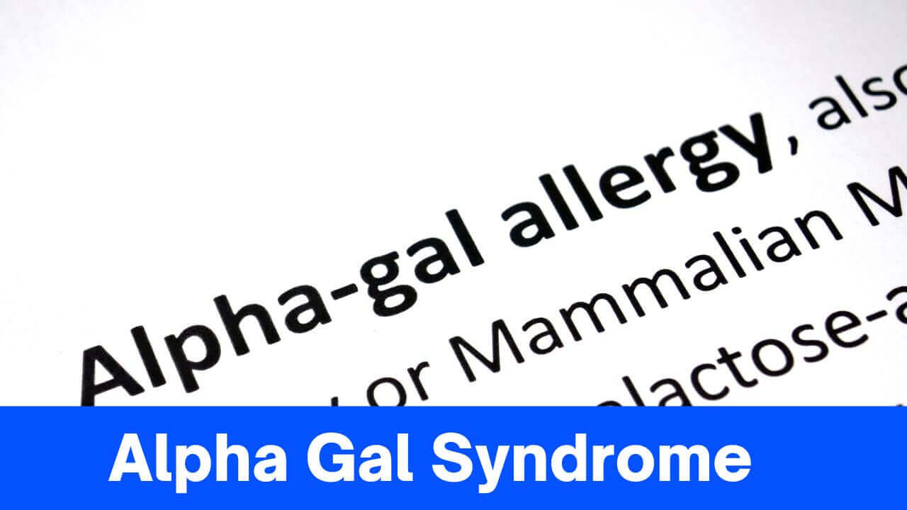 Alpha Gal Syndrome: Unraveling The Mysteries Of A Unique Food Allergy ...