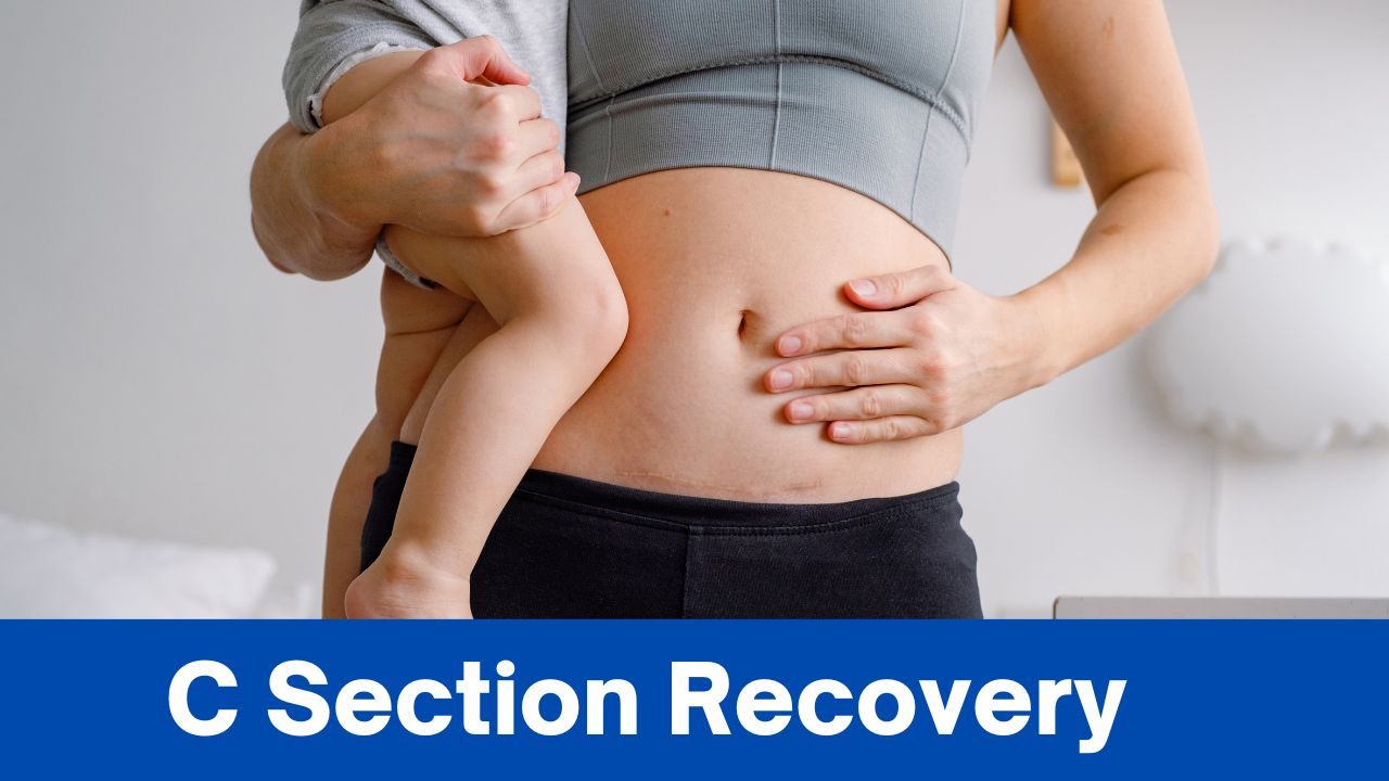 Mastering C Section Recovery: 10 Expert Tips For A Smooth Journey » 2026